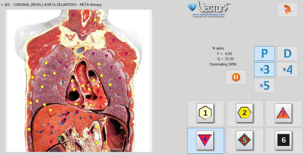 Meta therapy of 3D NLS Health Analyzer Biofeedback Therapy – Suyzeko