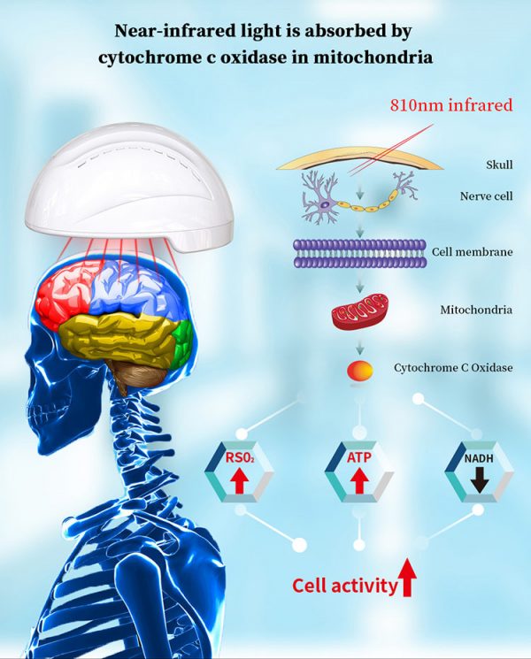 810nm Photobiomodulation Machine For PBM Dementia Treatment