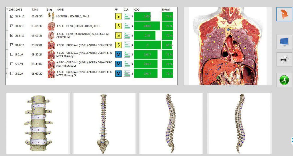 report of 3D NLS Health Analyzer Biofeedback Therapy – Suyzeko